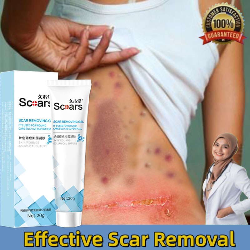 krim hilangkan parut hitam ubat hilang parut kudis Scar Removal Cream ...