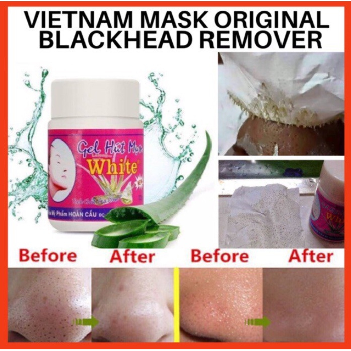 BLACKHEAD WHITEHEAD REMOVER MASK (MASK VIETNAM GEL) | Shopee Malaysia