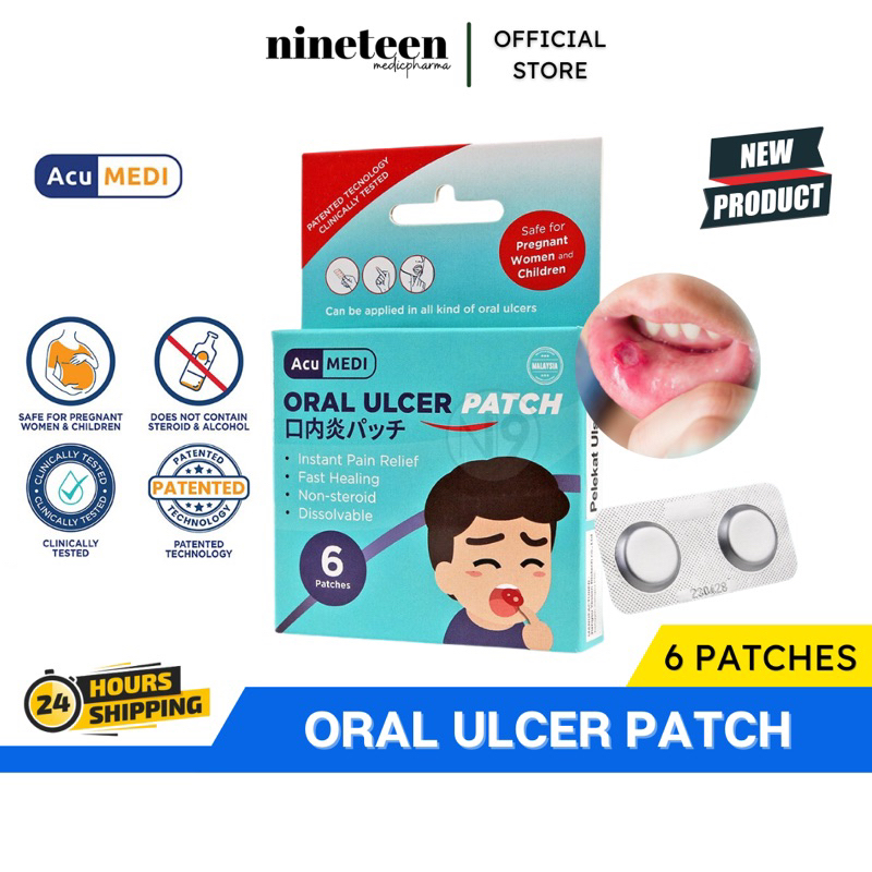 ACUMEDI Oral Ulcer Patch (6’s) | Shopee Malaysia
