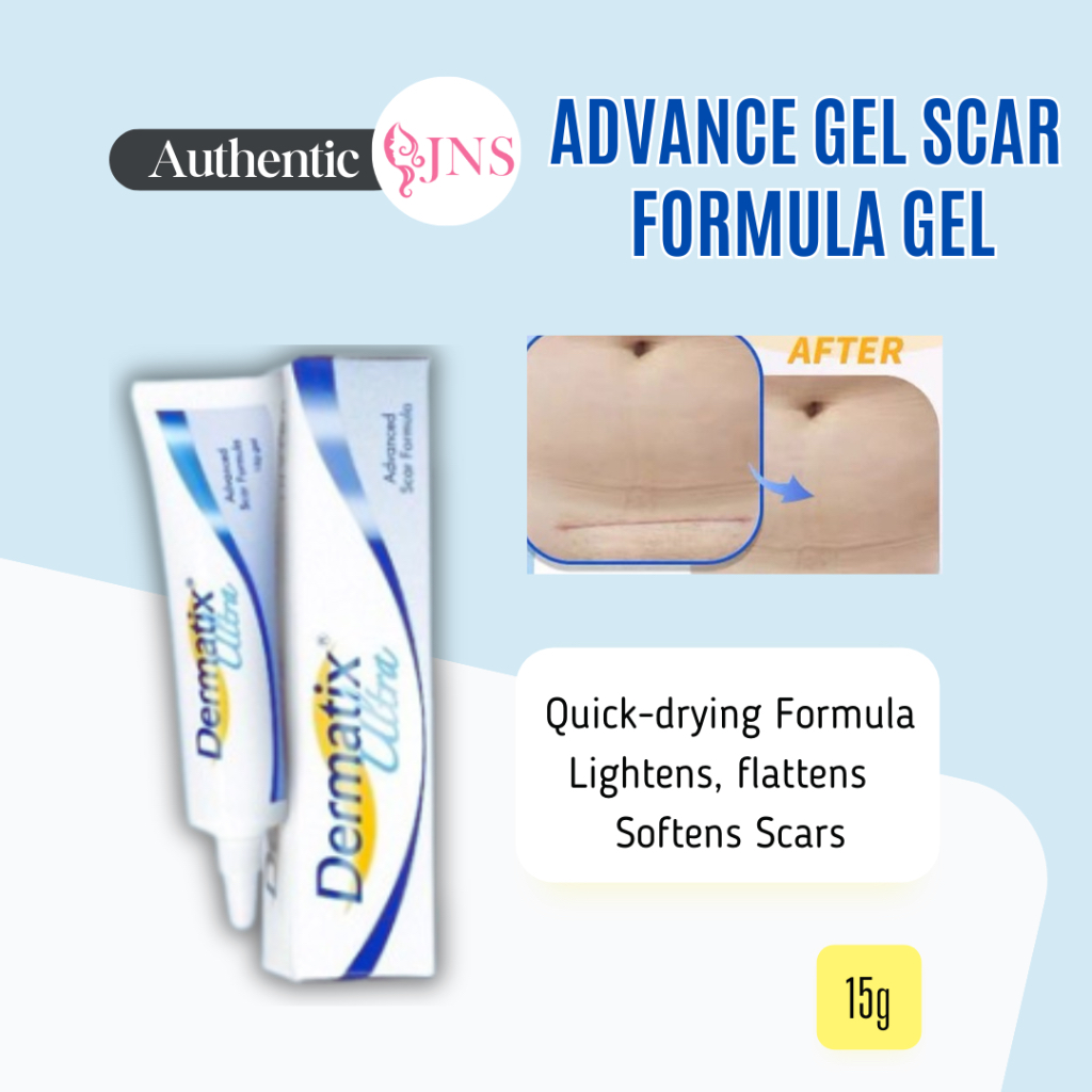 Dermatix Ultra Scar Gel/ Advanced Scar Formula (15g) | Shopee Malaysia