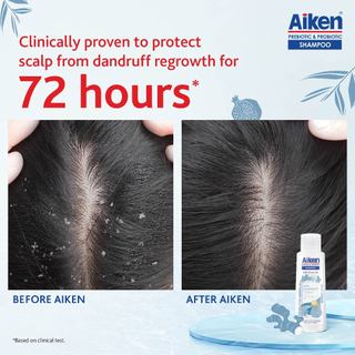 Aiken Anti Dandruff Shampoo 350g | Prebiotic | Probiotic | Niacinamide ...