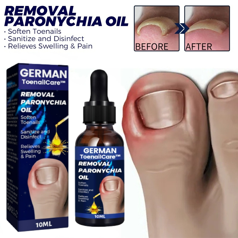 Anti Paronychia Relief Oil Ingrown Toenail Anti Fungal Toe Nail Stop ...