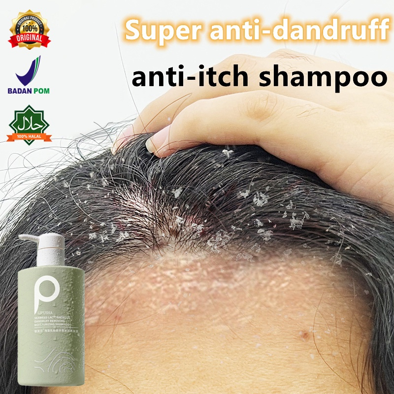 Shampoo kelemumur anti dandruff itchy scalp oil control remove mite ...