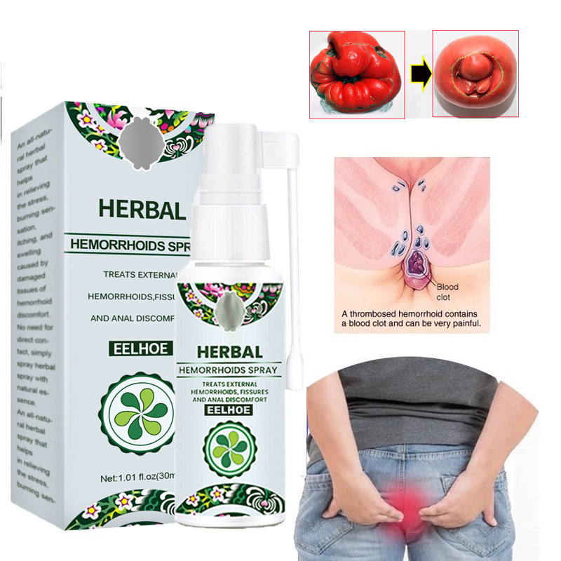 Hemorrhoid Spray Semburan Buasir Krim Buasir Antibacterial Herbs Hemorrhoids Treat Internal and ...