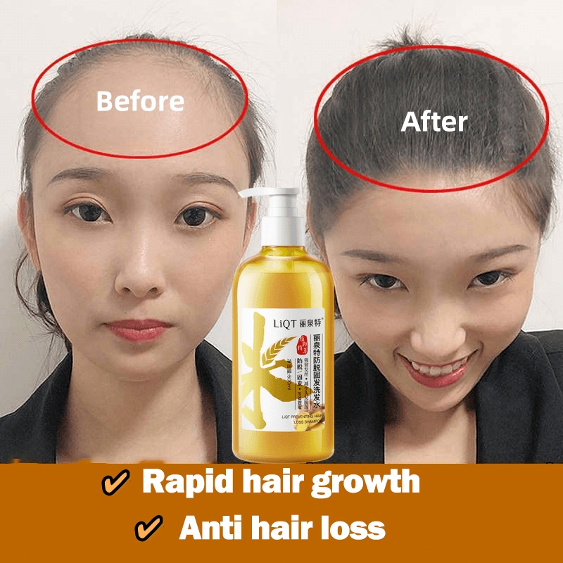 Hair growth shampoo 500ml shampoo rambut gugur-ginger shampoo-syampu ...