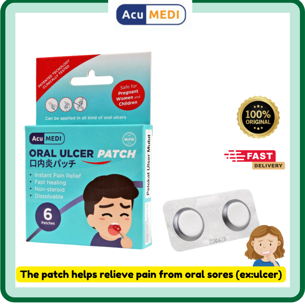 AcuMEDI Oral Ulcer Patch | 6 Patches | Pain Relief for Mouth Ulcers ...