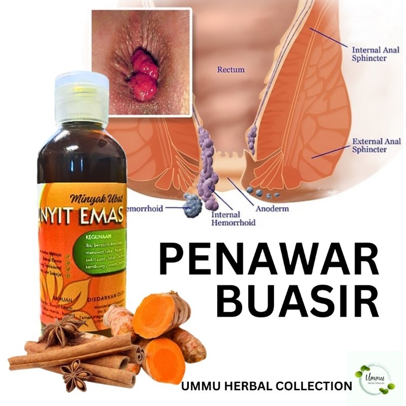 Minyak Ubat Kunyit Emas Penawar Buasir, Luka dan Radang | Shopee Malaysia