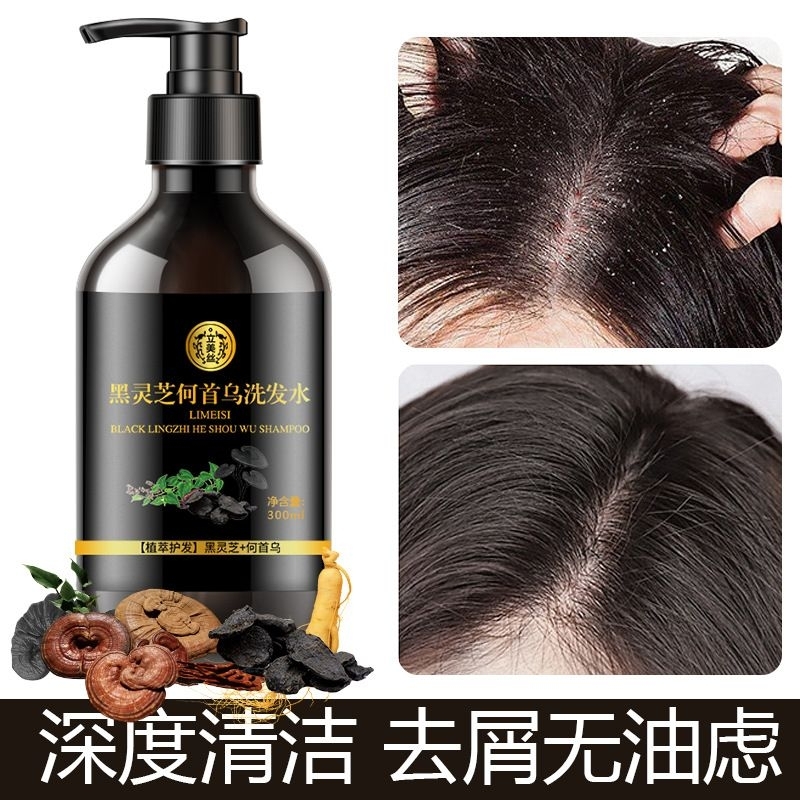 立美丝黑灵芝何首乌洗发水🇲🇾Limeisi Black Ganoderma Lucidum and Polygonum Multiflorum Shampoo | Shopee Malaysia