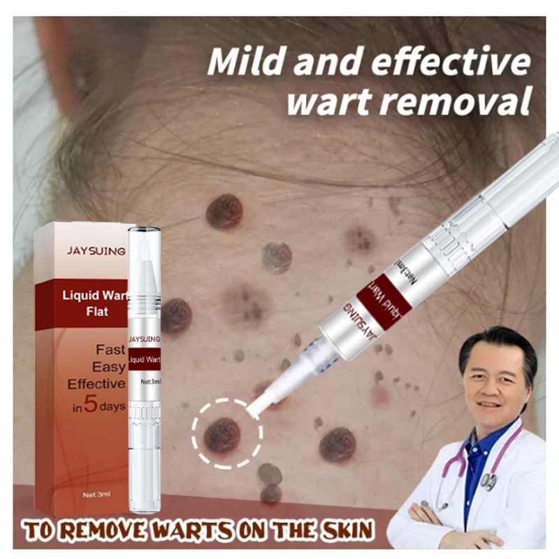 WART REMOVAL LIQUID PEN UBAT KETUAT BUANG TAHI LALAT WART TREATMENT ...