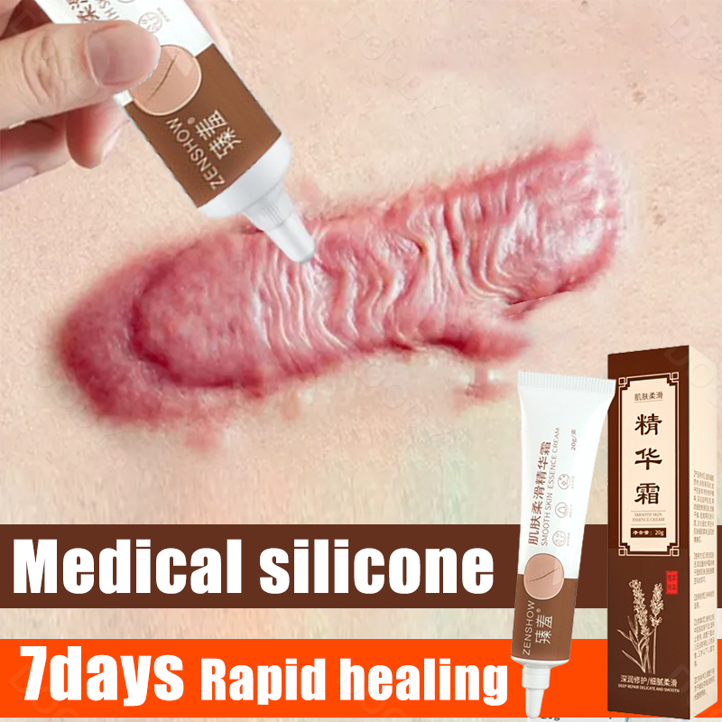 Krim Hilangkan Parut Hitam menghilangkan bekas luka lama keloid scar ...