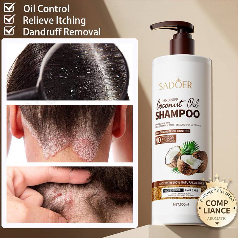 SADOER SHAMPOO ANTI DANDRUFF shampoo anti kelemumur rawatan kelemumur penghilang kelemumur kulit ...