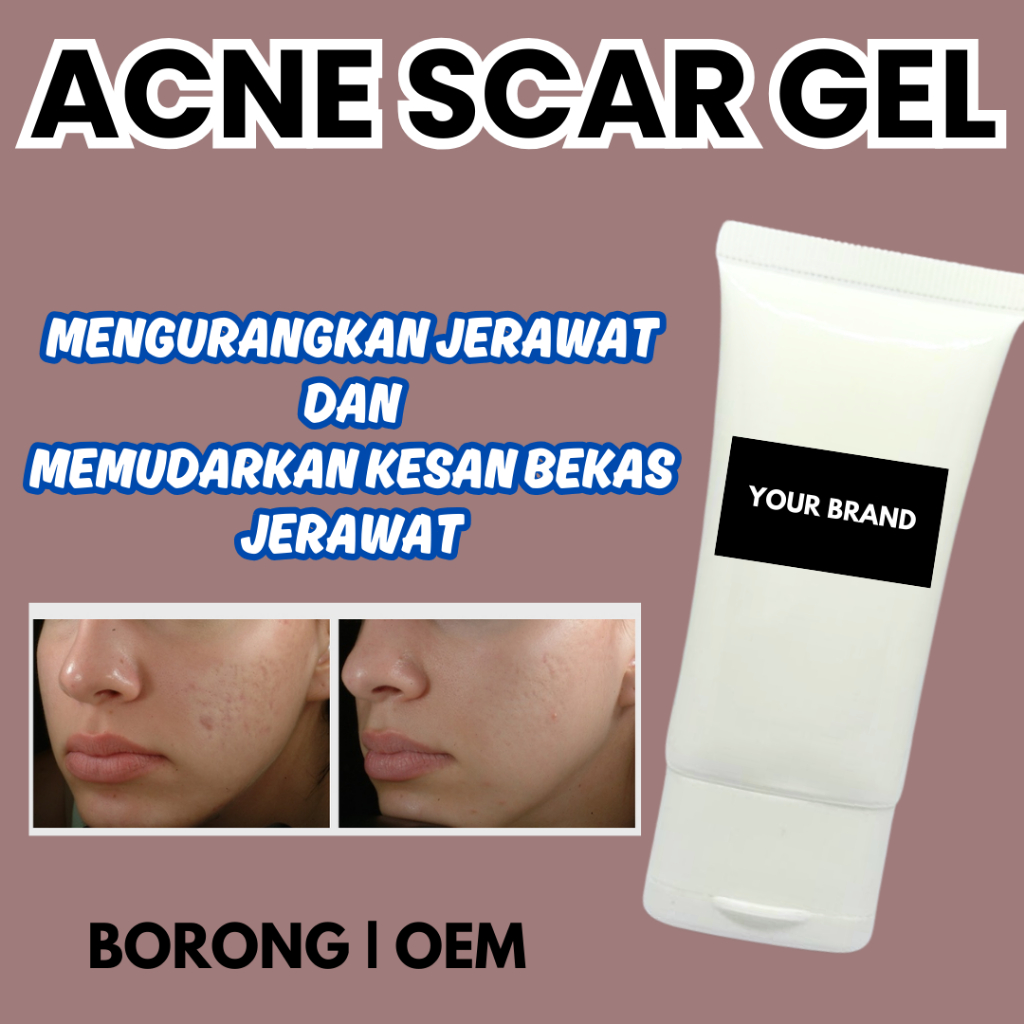 [JELITAEMAS OEM] 30G SCAR CREAM GEL/KRIM PARUT SELULIT/CELLULITE JENAMA ...
