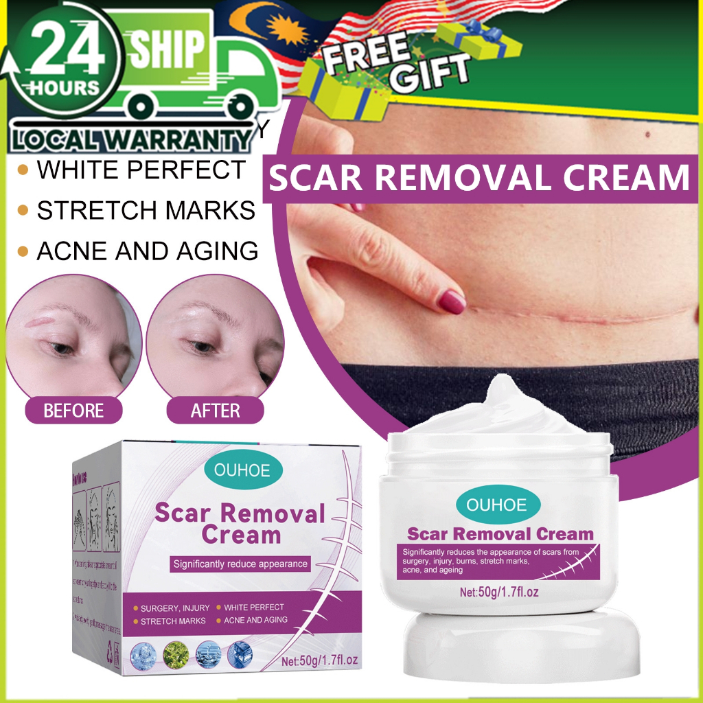 krim hilangkan parut hitam Menghilangkan bekas luka lama Ubat parut kaki Mosquito bite scar ...