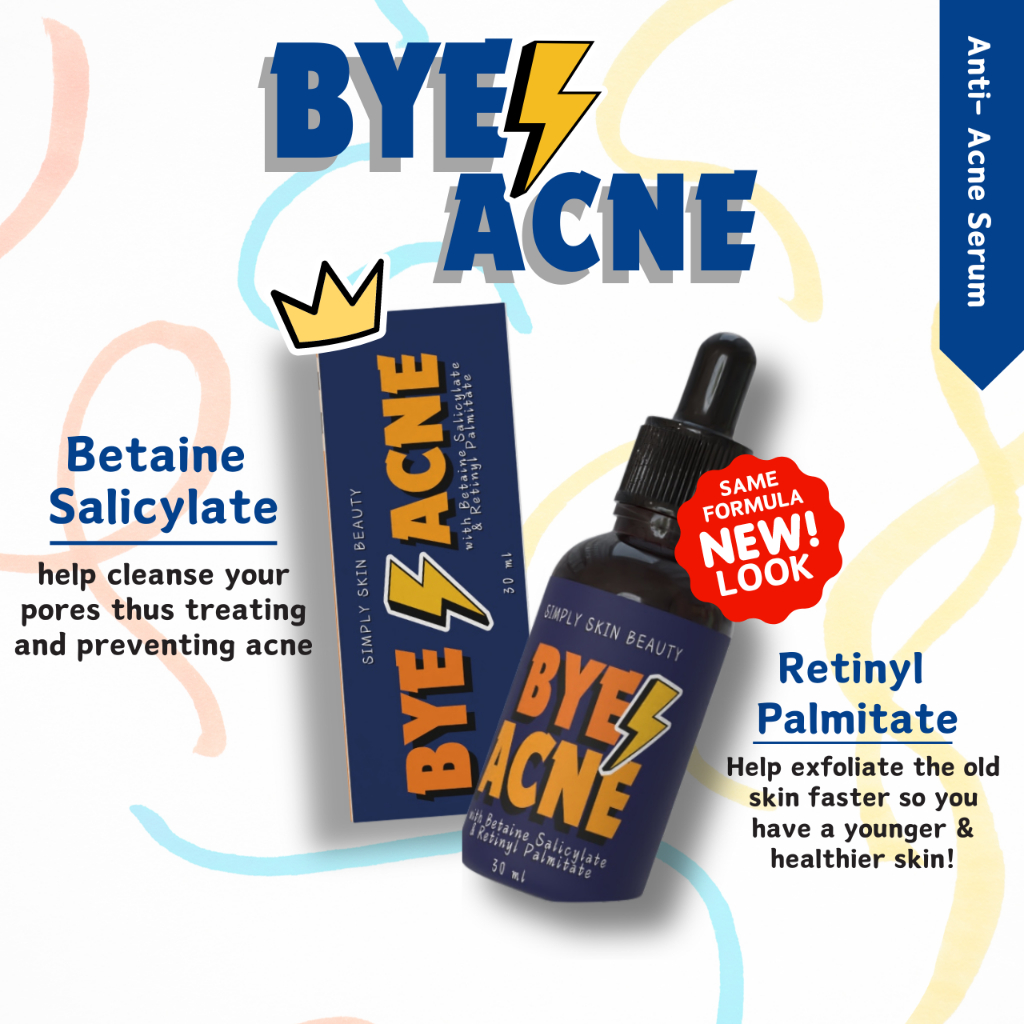 Simply Skin Bye Acne with Salicylic Acid and Retinyl Palmitate for Acne ...