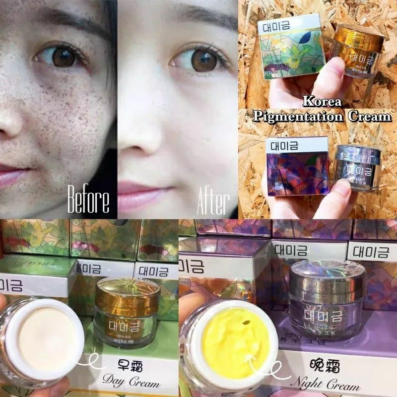 100% ORIGINAL COMBO KOREAN DEMIJINE FACE CREAM DAY & NIGHT ANTI ACNES ...