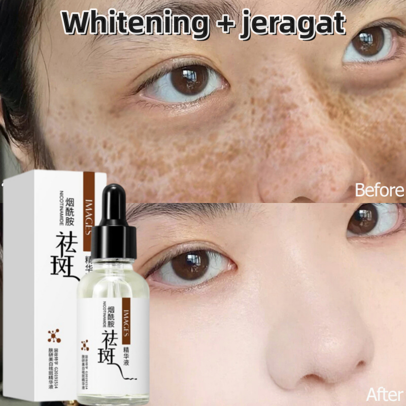 krim jeragat niacinamide cream jeragat jeragat degil berkesan set ...