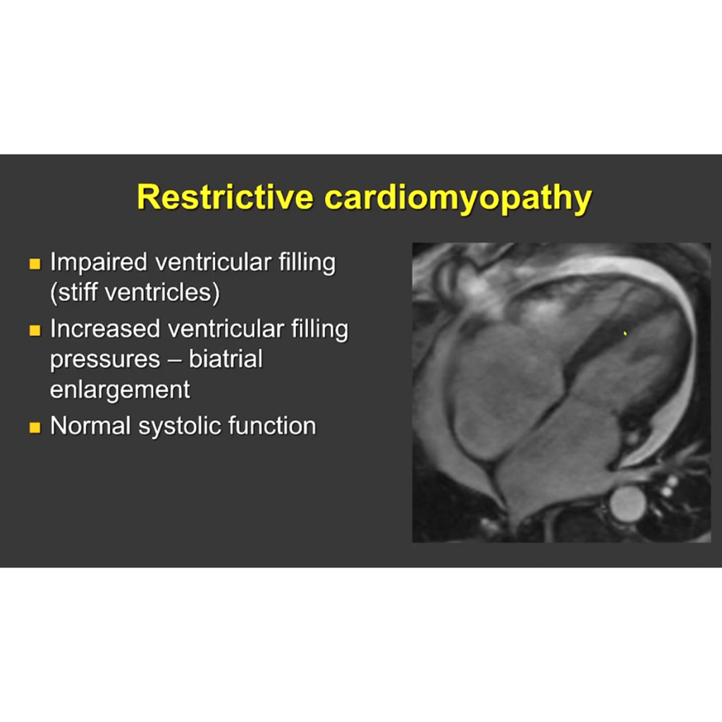 [Radiology] MRIonline Mastery Series: Cardiac MRI of Non-Ischemic ...