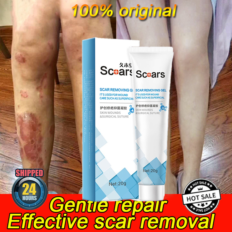 100% Effective Scar cream Scar removal cream Keloid scar remover 20g ...