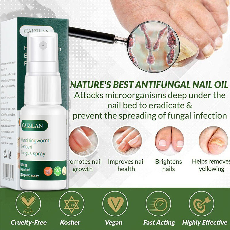 Anti Fungal Foot Spray Nails Toe Fungus Feet Spary Onychomycosis ...