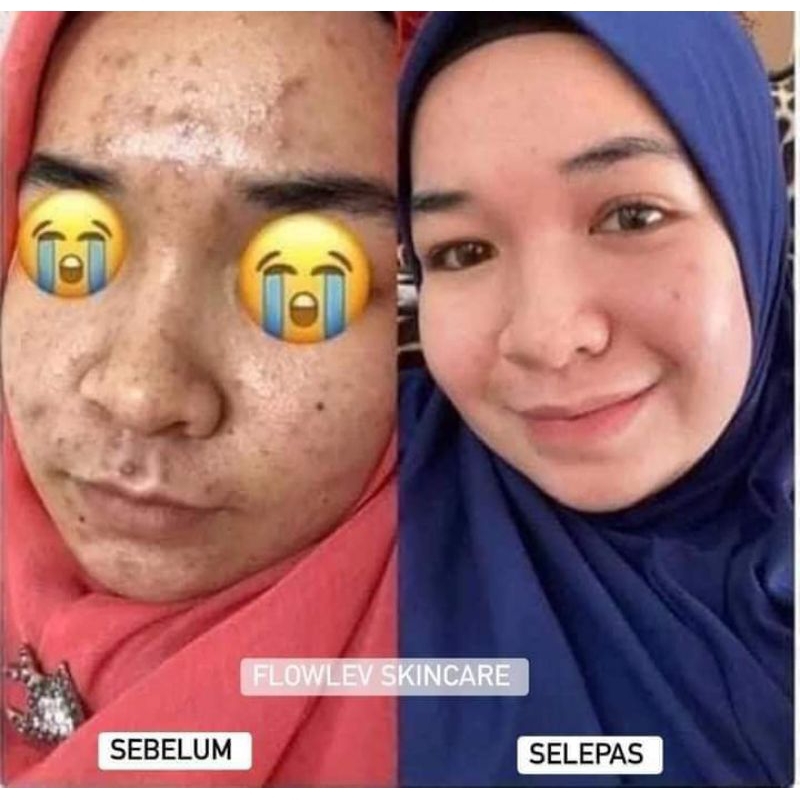 💥𝐎𝐑𝐈𝐆𝐈𝐍𝐀𝐋 HQ💥FLOWLEV SKINCARE 4IN1 | SANGAT BERKESAN N VIRAL💥 | Shopee ...