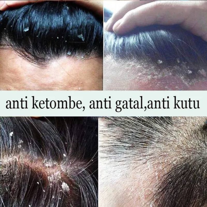LIFUSHA SEAWEED SHAMPOO ANTI-DANDRUFF OIL CONTROL Shampoo rumpai laut ...
