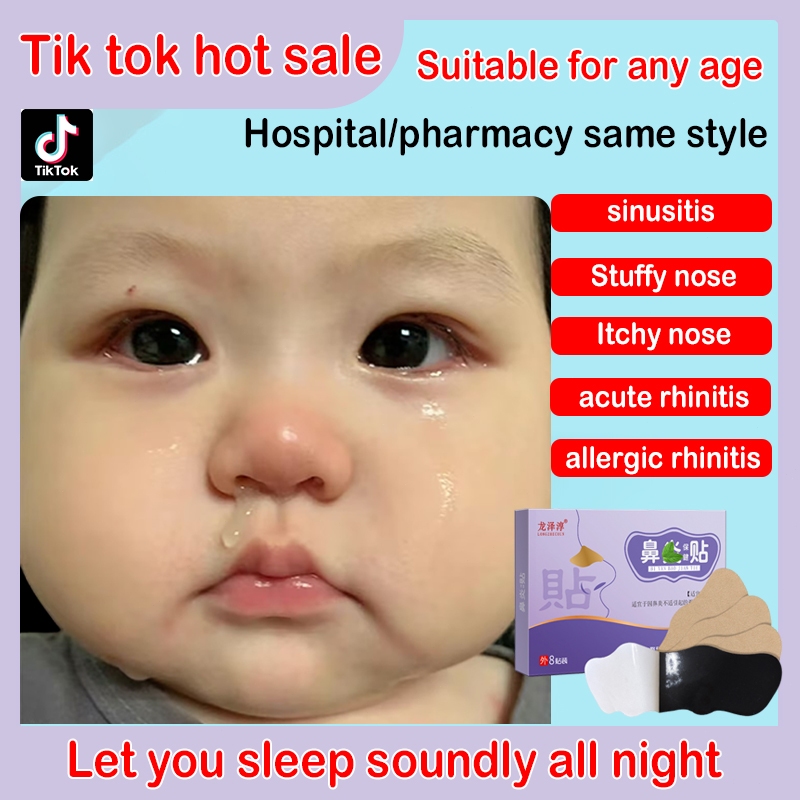 Rhinitis patch Herbal formula allergic rhinitis acute rhinitis Stuffy ...