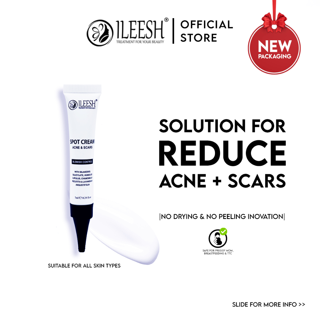 ILEESH Spot Cream (Reduce Acne And Scars) - 7ml | Skincare | Shopee ...