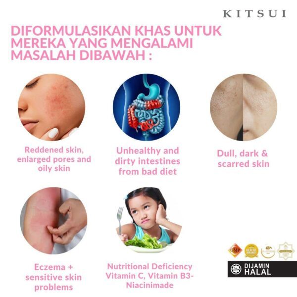 KITSUI Whitie Snow ProBiotic + PreBiotic + Vitamin C (17's x 15g ...