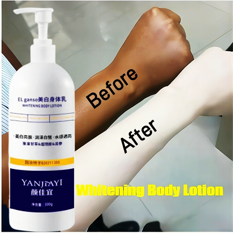 Whitening Body Lotion Niacinamide Bleaching Skin Whitening losyen ...