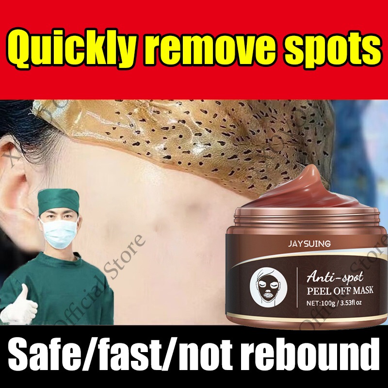 freckle removal mask Whitening Freckle Removal Fade Dark Spots In Two ...