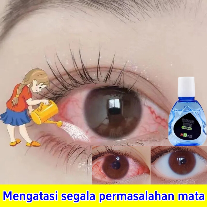 Eye Drop Ubat Mata Eyeheal Eye Drops For Dry Eye Ubat Mata Rabun Ubat ...