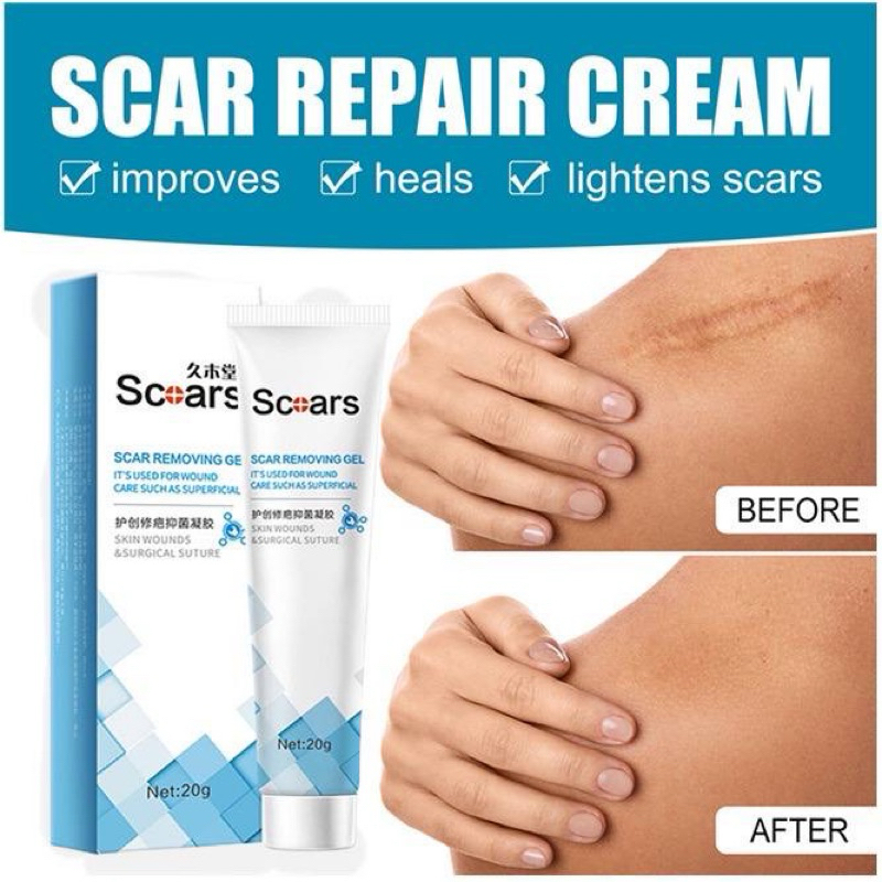 SKIN SCAR REMOVING GEL krim penghilang parut lama dan parut baru ...