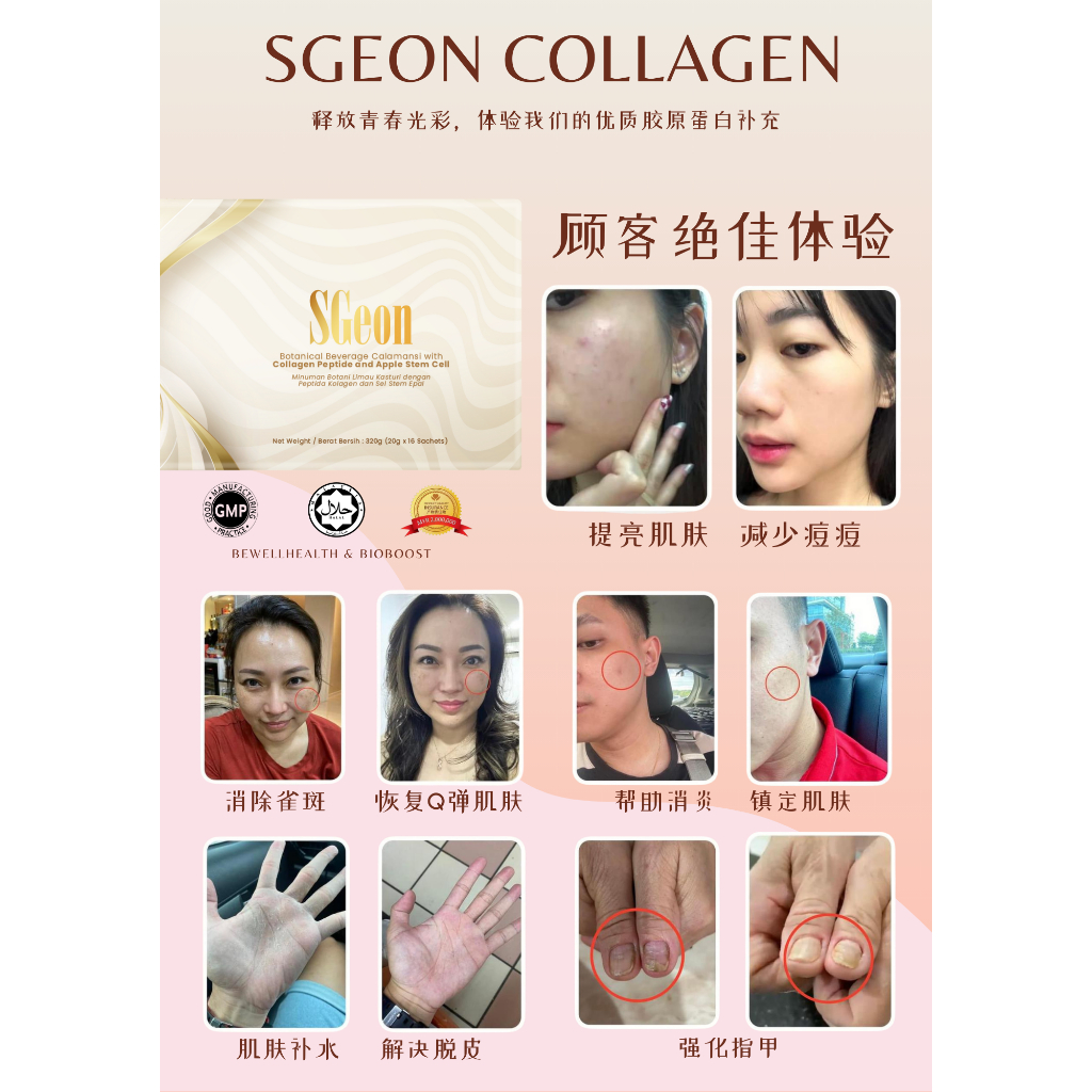(100%original stock) SGEON collagen 抗氧美颜强化关节饮 全新4大原料 胶原蛋白 呵护关节和肌肤健康 ...