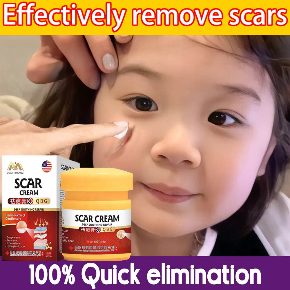 USA Scar Removal Cream 15g Efficient repair burn scald scar cream Acne ...