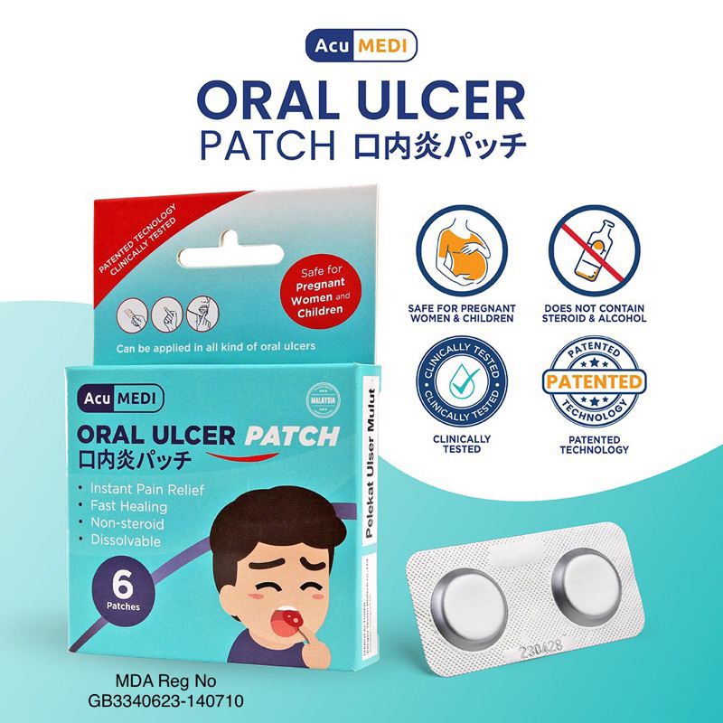 acumedi oral ulcer patch mouth ulcer ulser mulut 6's | Shopee Malaysia