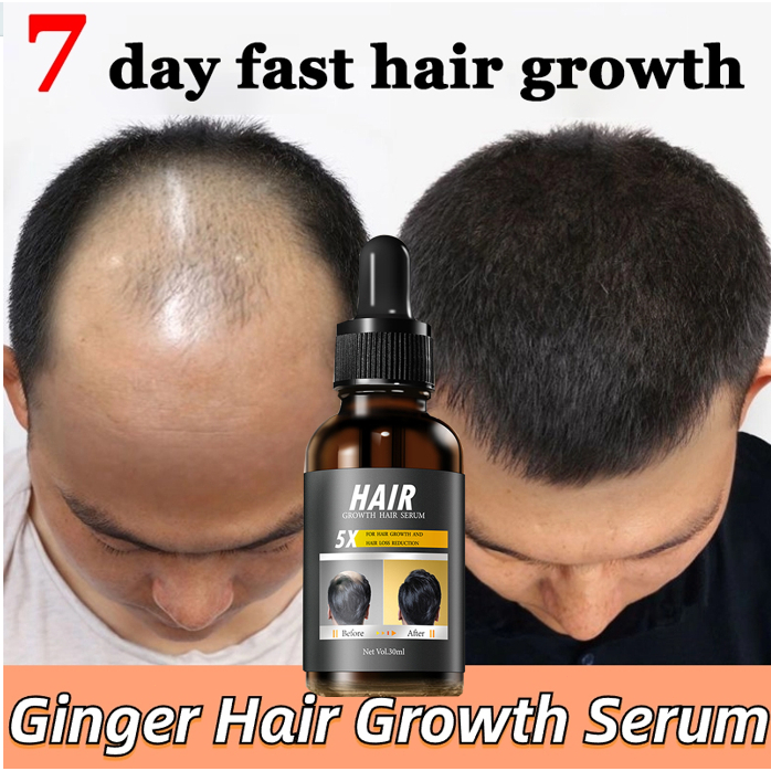 hair growth serum fast hair growth-Serum penumbuh rambut-Obat penumbuh ...