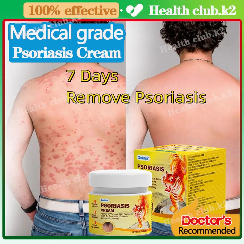 Psoriasis Cream Antifungal cream Eczema cream Cream gatal kulit 20g ...