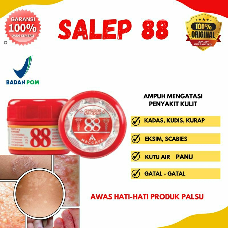 Salap / Salep 88 Jangkitan Penyakit Kulit Gatal - Gatal Original 6 gram ...