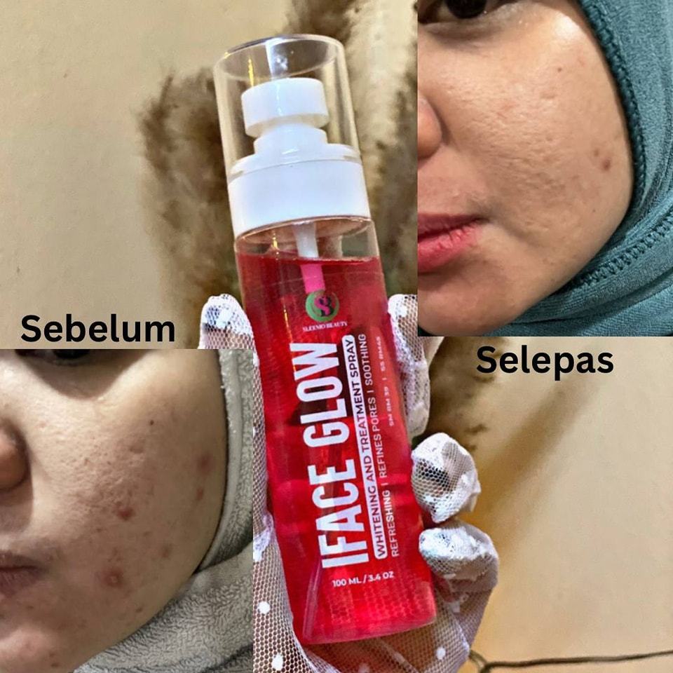 SLEEMO IFACE GLOW WHITENING & TREATMENT 2025!! | Shopee Malaysia
