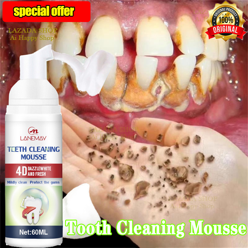 【special offer】 Teeth whitening mousse toothpaste Remove stone tartar ...