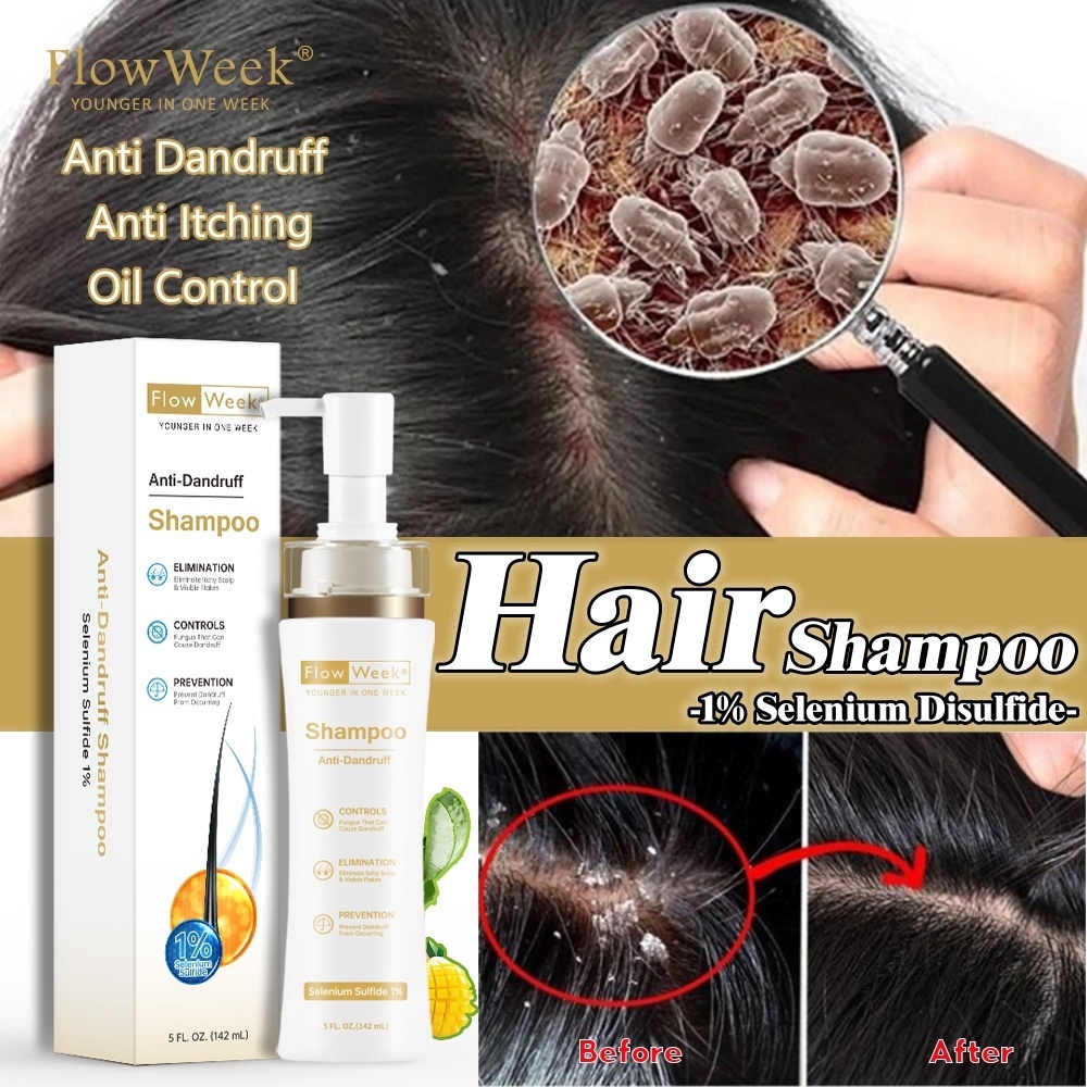 Flowweek Hair Shampoo Anti Dandruff Lice Remover Anti Mite Oil Control Scalp Itching Syampoo ...