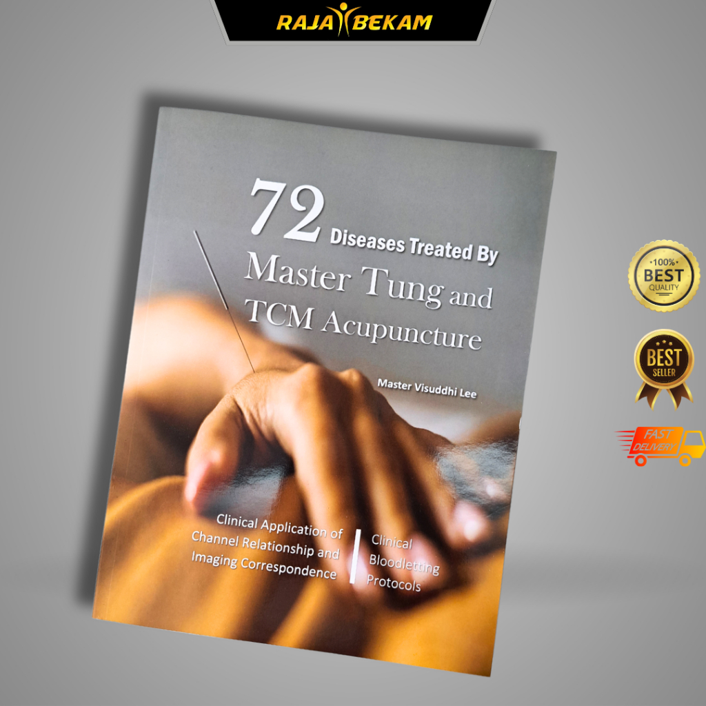 Buku 72 Diseases Treated By Master Tung and TCM Acupuncture | Shopee ...