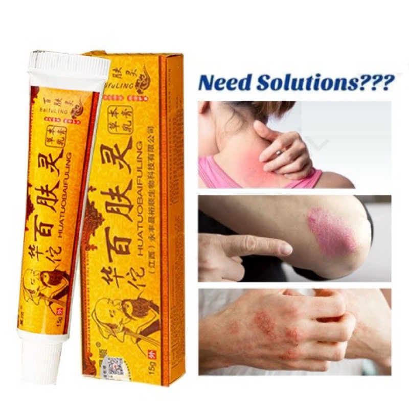 Cream kuning BaiFuLing Eczema Psoriasis Antifungal Ringworm Cream Krim ...