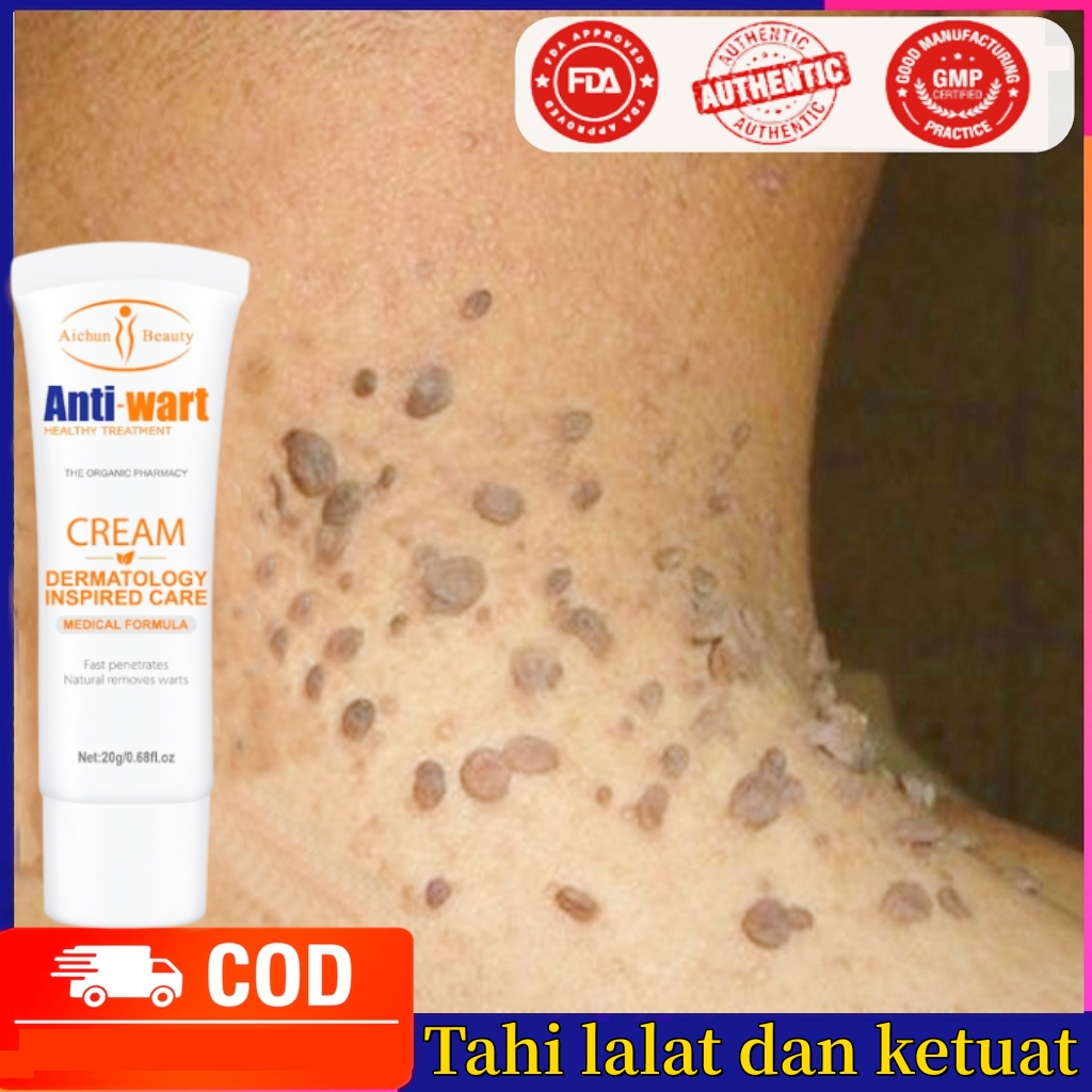 Ubat ketuat Ubat hilangkan tahi lalat Skin tag remover Buang tahi lalat ...
