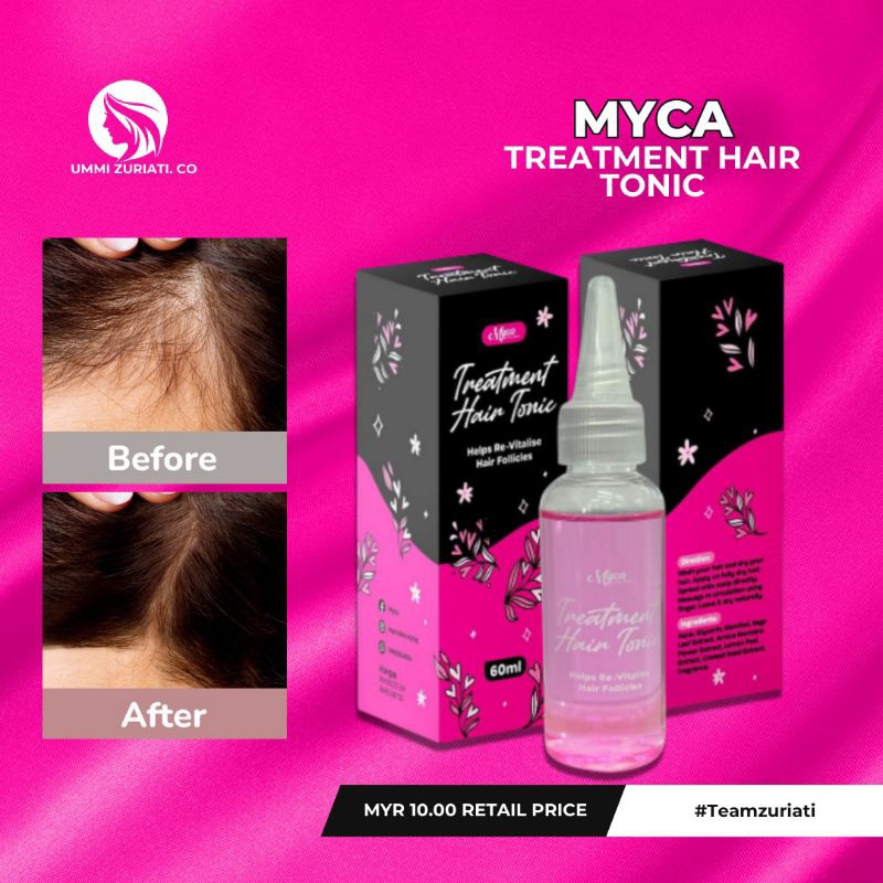 🌸MYCA TREATMENT HAIR TONIC ORIGINALLL Hq🌸 | Shopee Malaysia