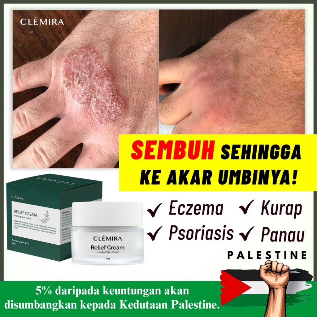 Clemira Relief Cream Ekzema Ubat Gatal Kulit Panau Kurap Ubat Gatal ...