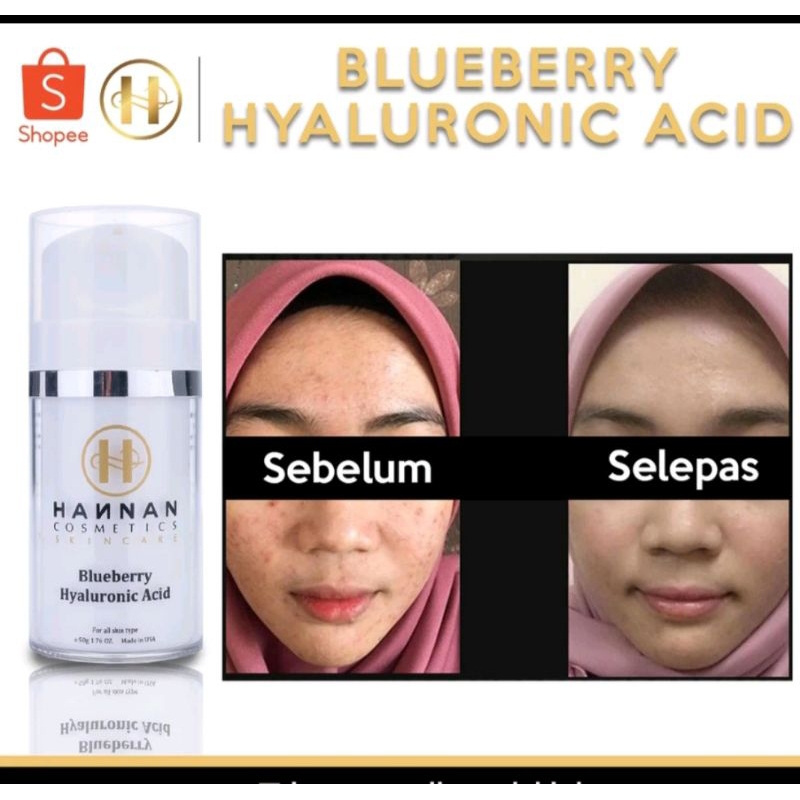 ORIGINAL Blueberry Hyaluronic Acid(50g) | Shopee Malaysia