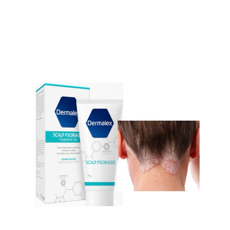 DERMALEX SCALP PSORIASIS TREATMENT GEL 75G | Shopee Malaysia