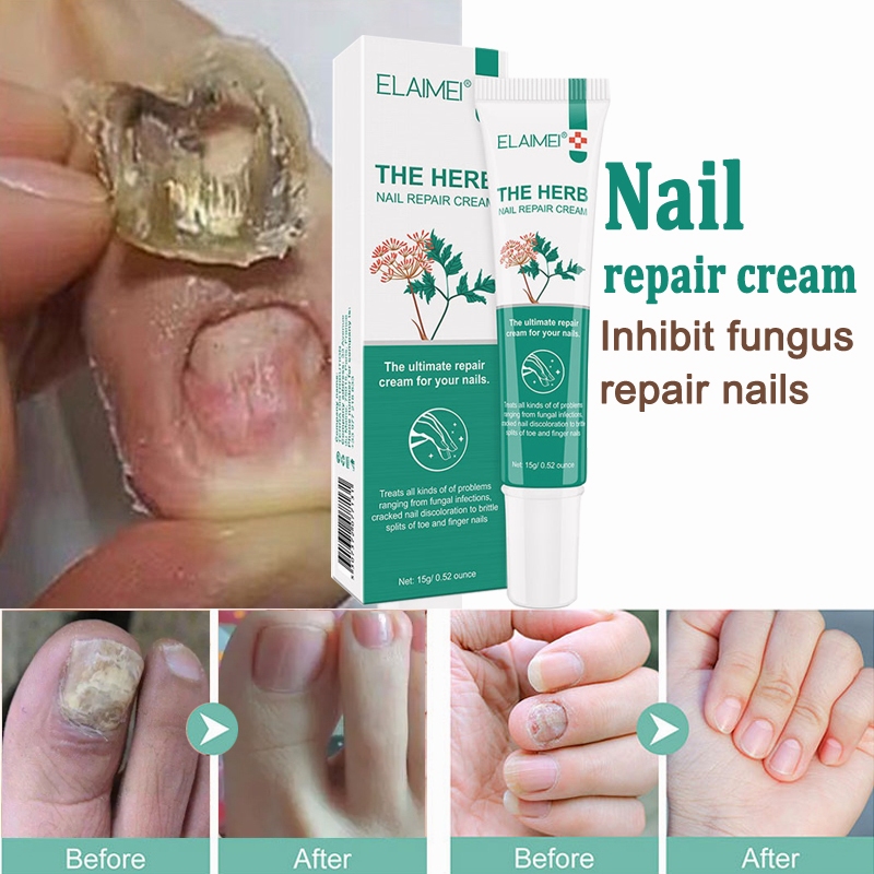 Nail repair Cream 15g Quick Repair DamagedNourishing nails, anti ...
