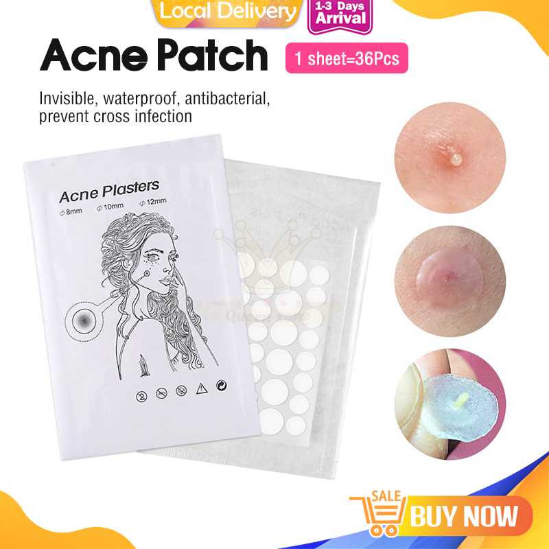 Waterproof Oil-control Acne Patch Invisible Acne Patch Blemish ...